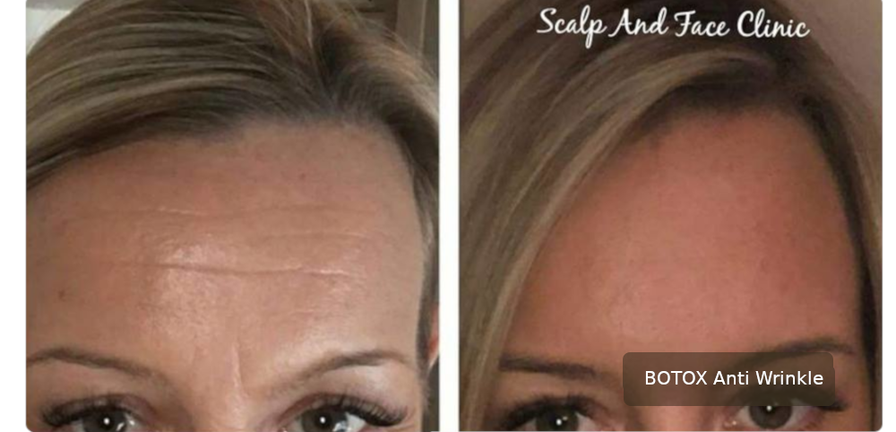 Gallery - Scalp and Face Clinic